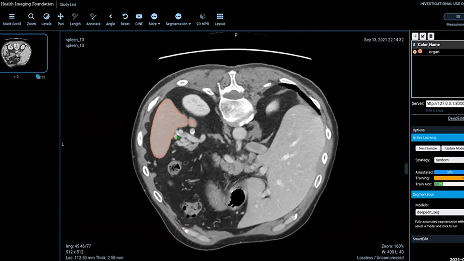 Clara Holoscan | 医療機器向け AI プラットフォーム - NVIDIA