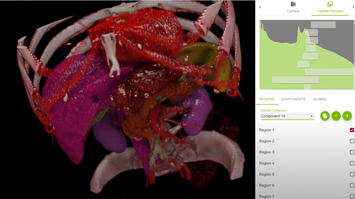 NVIDIA Holoscan | AI Platform for Medical Devices | NVIDIA