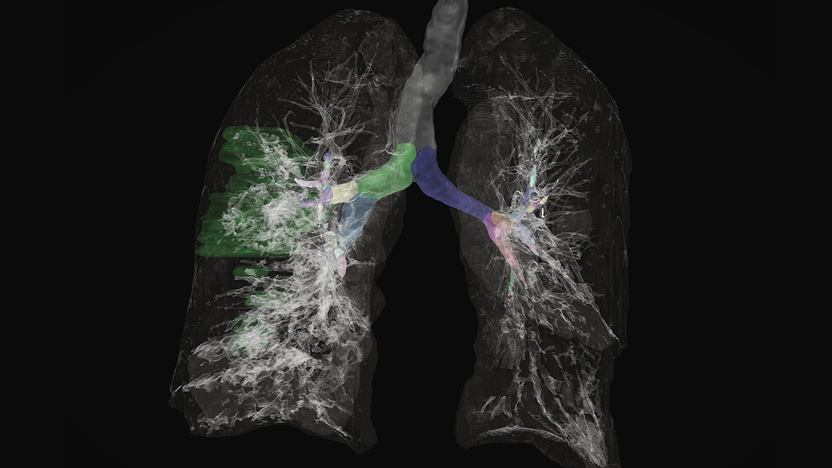 Computação Inteligente para Serviços de Saúde | NVIDIA Clara