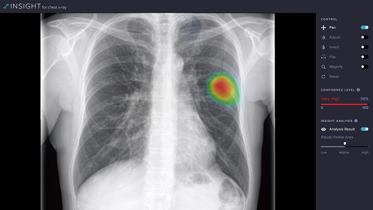 Solutions for Healthcare and Life Science Industries | NVIDIA
