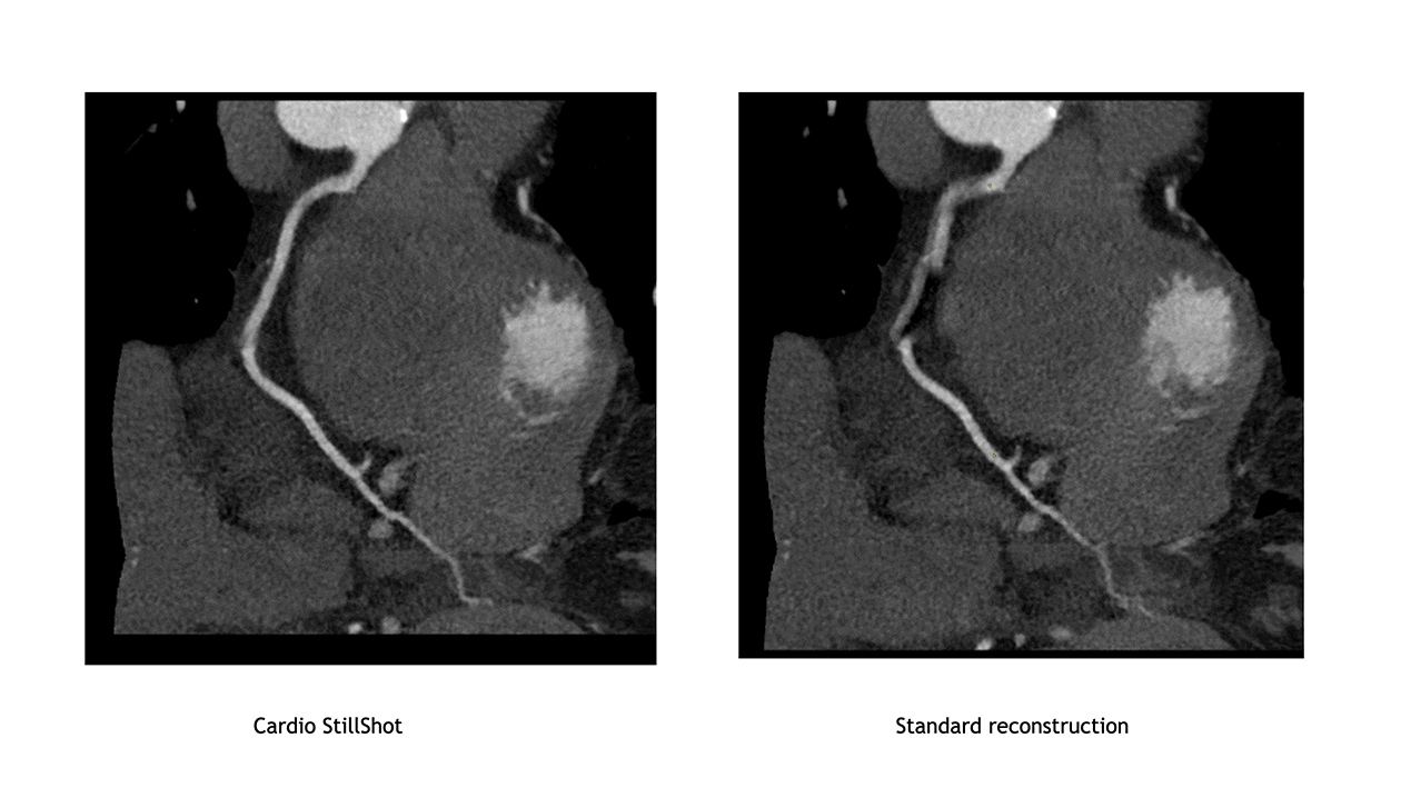 AI-Powered Medical Devices | NVIDIA