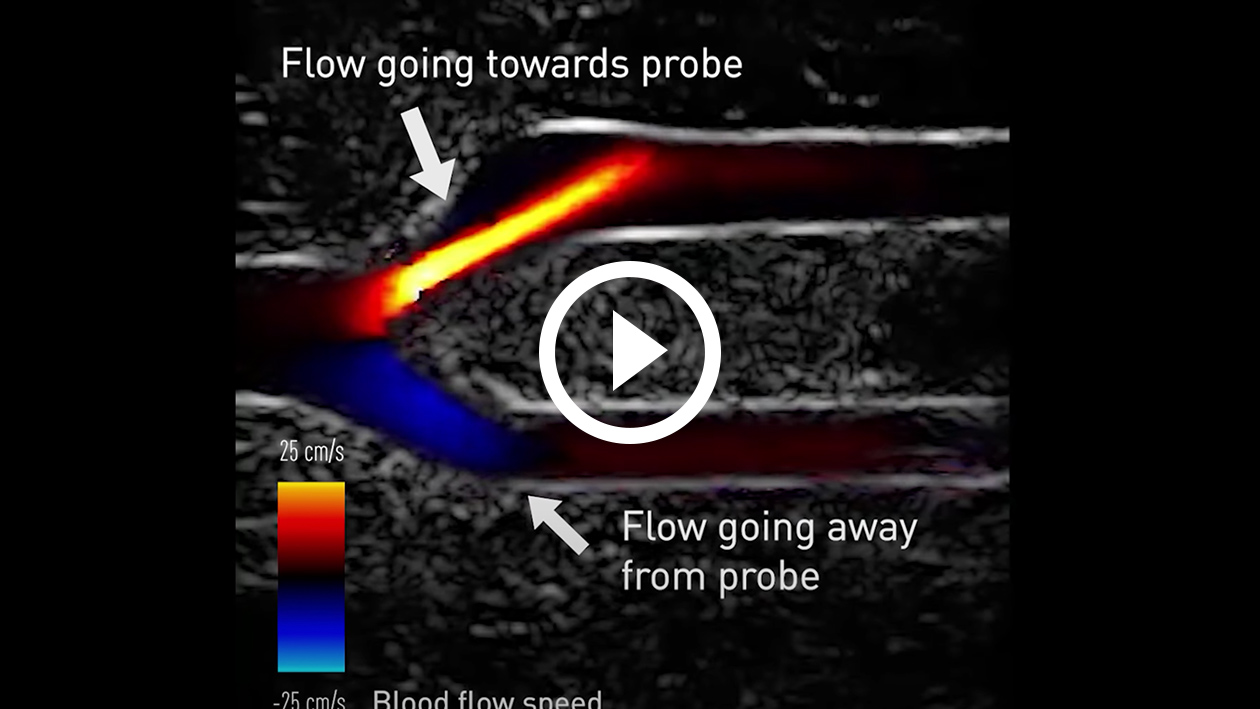 AI-Powered Medical Devices | NVIDIA