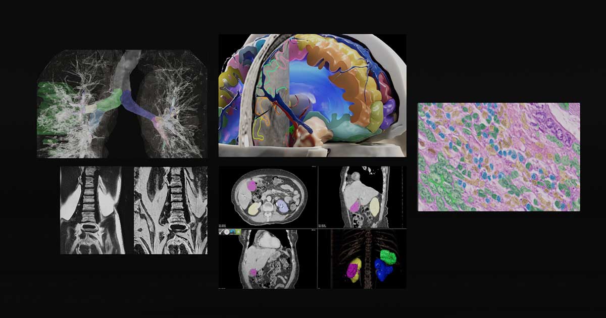 Medical Imaging Solutions for the Healthcare Industry | NVIDIA