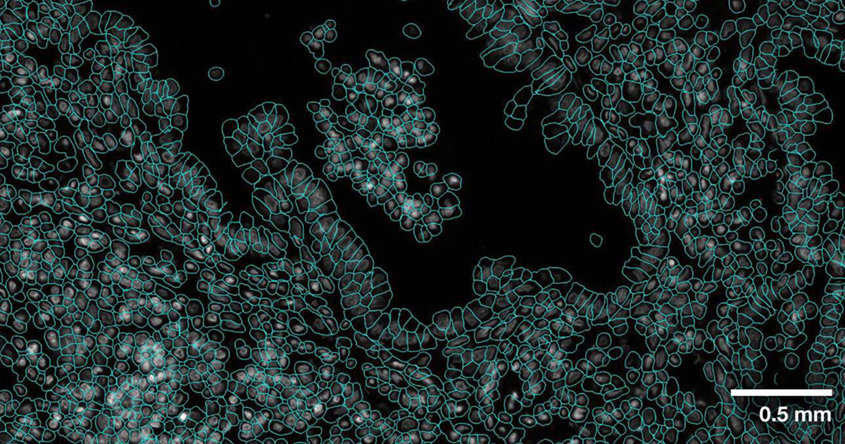 Genomics Analysis with NVIDIA AI and Computing Solutions | NVIDIA