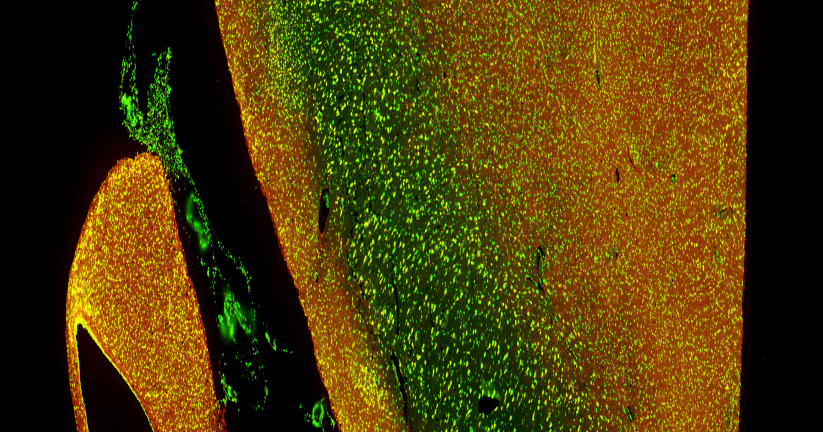 Ai Platform For Spatial Transcriptomics Use Case Nvidia
