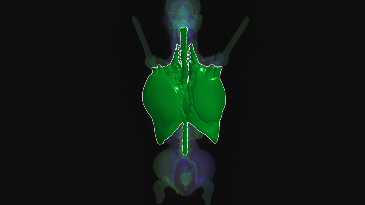 RaySearch Delivers AI-Powered Oncology With NVIDIA GPUs | NVIDIA ...