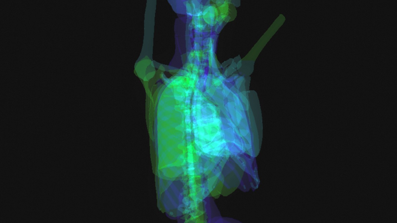 RaySearch Delivers AI-Powered Oncology With NVIDIA GPUs | NVIDIA ...